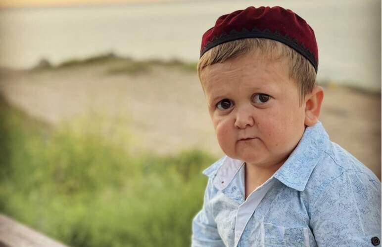 How Old Is Hasbulla? His Age, Net Worth & Hasbulla Magomedov